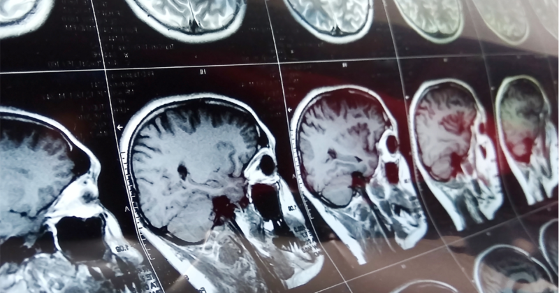 Traumatic brain injury treatment and assessment for first responders