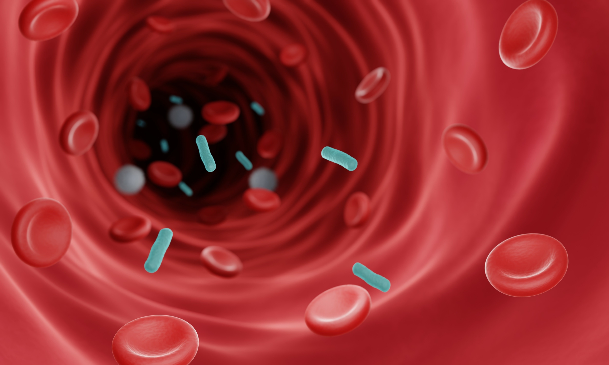 Sepsis: A Paramedic's Guide to Rapid Recognition and Lifesaving ...